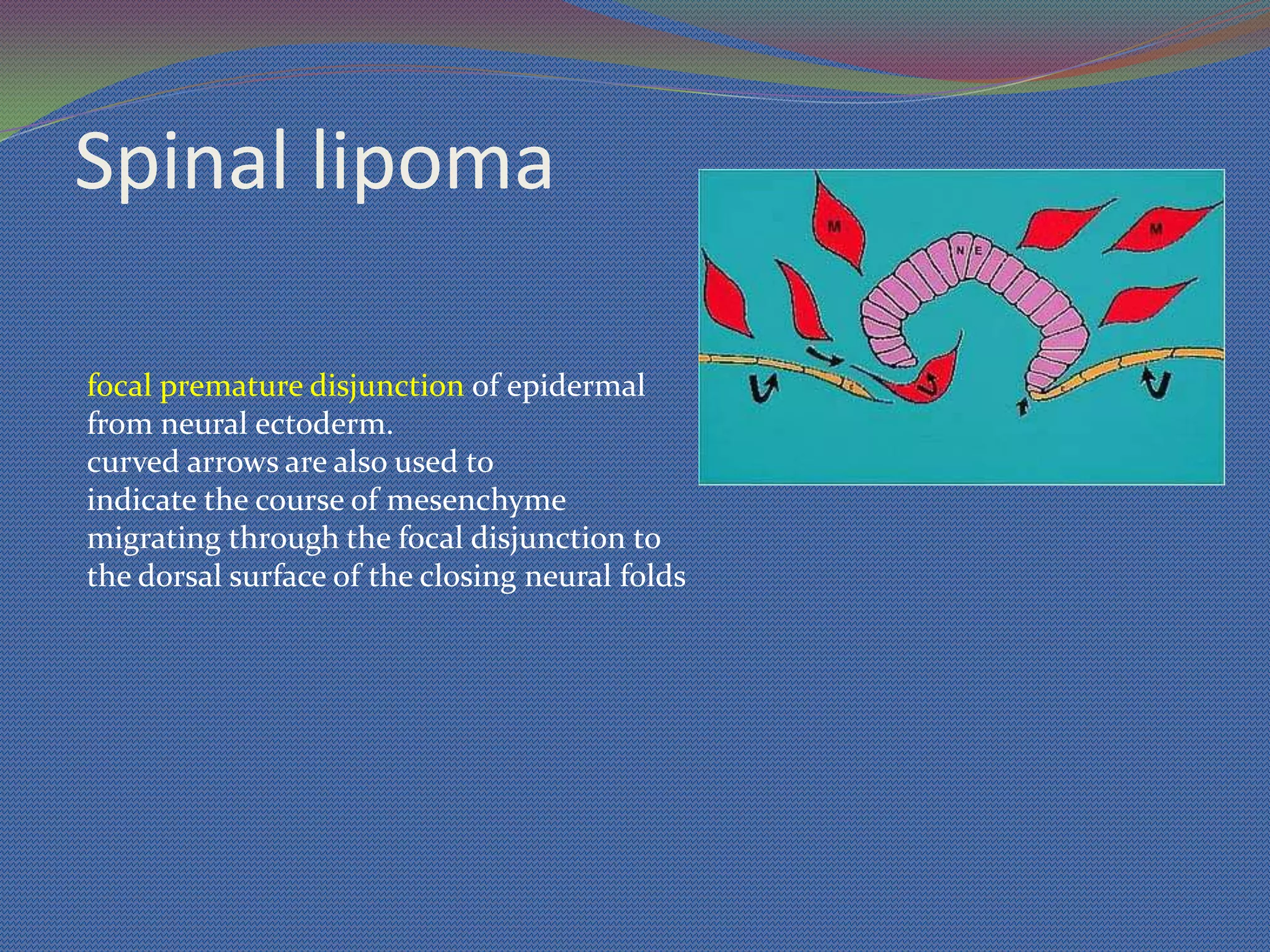 Imaging of congenital anomalies of spine and spinal cord | PPTX