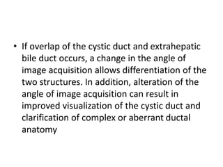 Imaging of cystic duct | PPTX