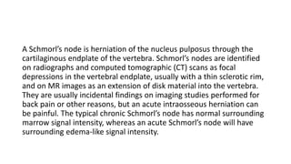 Imaging of lumbar spondylosis | PPTX