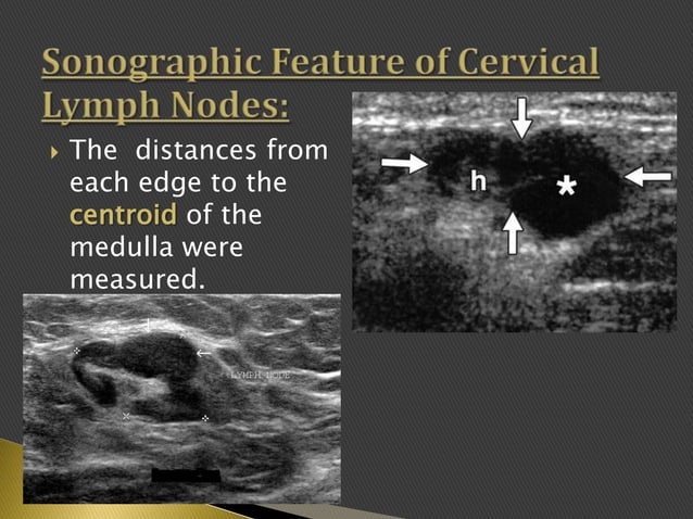 Imaging of enlarged lymph node | PPTX