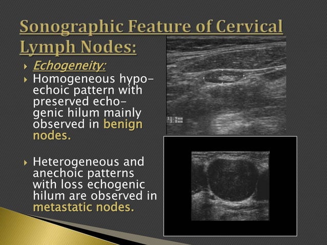 Imaging of enlarged lymph node | PPTX
