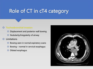 imaging of esophagus.ppt