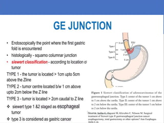 imaging of esophagus.ppt
