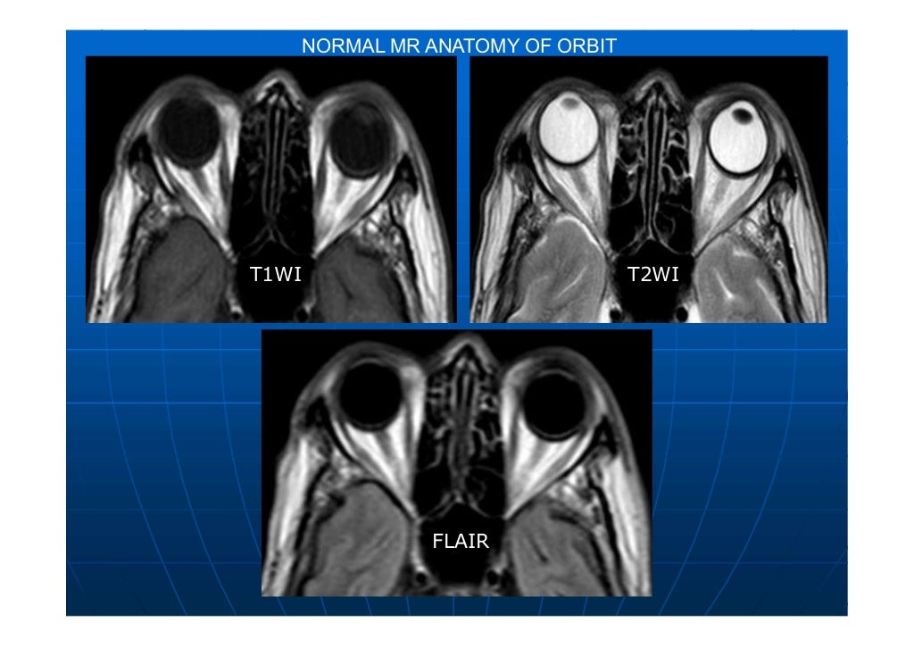 Imaging of eye and orbit