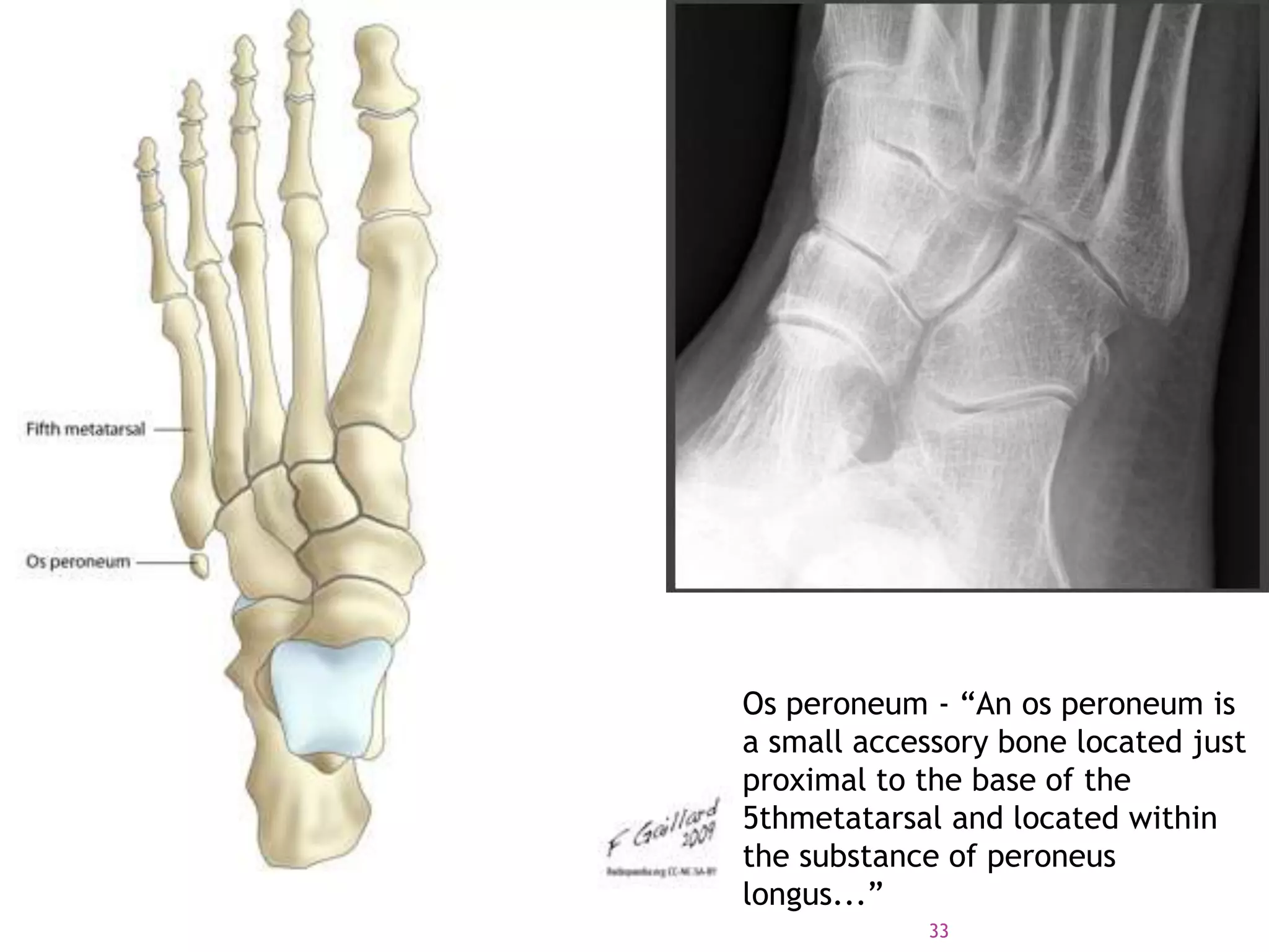 Imaging Modalities For Non-Acute Pathologies Of The Foot And Ankle – PEHHNU