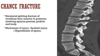 Imaging of fractures on Xray, CT and MRI.pptx