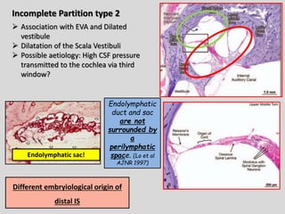 Imaging of hearing loss ESHNR 2019 cinisi | PPTX