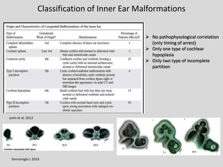 Imaging of hearing loss ESHNR 2019 cinisi | PPTX