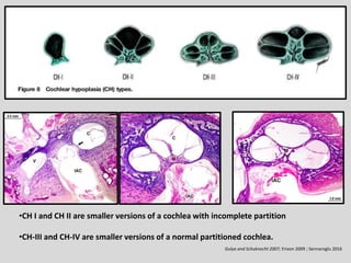 Imaging of hearing loss ESHNR 2019 cinisi | PPTX
