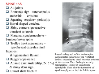 Imaging of inflammatory arthritis ppt | PPTX