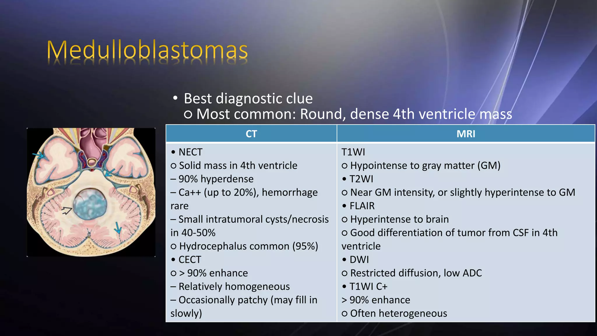 IMAGING OF INTRAVENTRICULAR TUMORS | PPTX