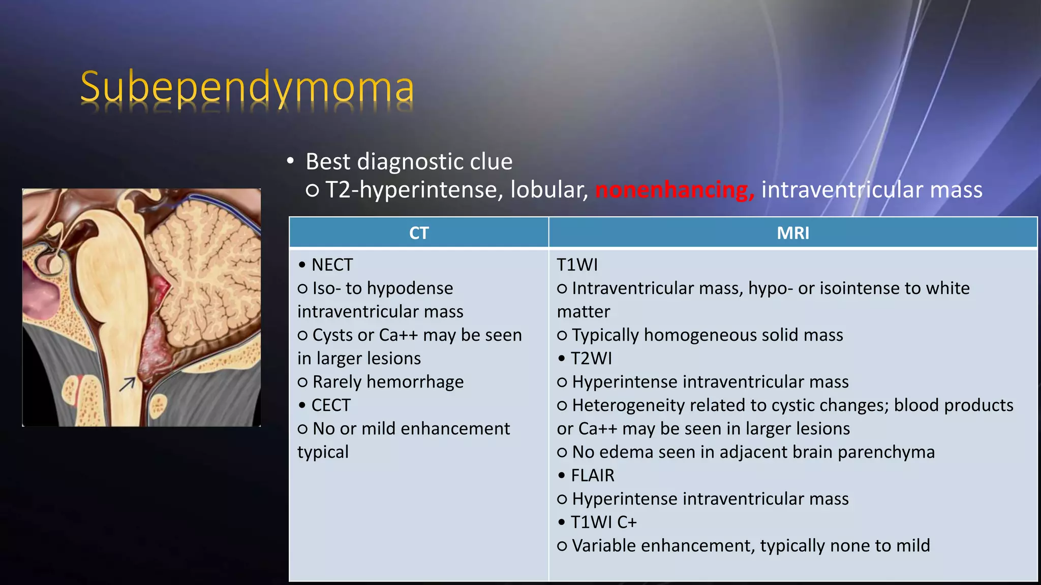 IMAGING OF INTRAVENTRICULAR TUMORS | PPTX