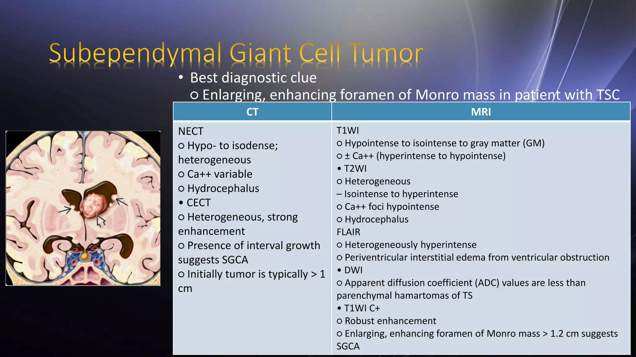 IMAGING OF INTRAVENTRICULAR TUMORS | PPTX