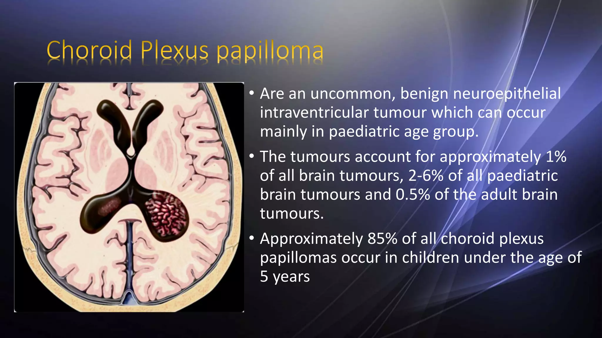 IMAGING OF INTRAVENTRICULAR TUMORS | PPTX