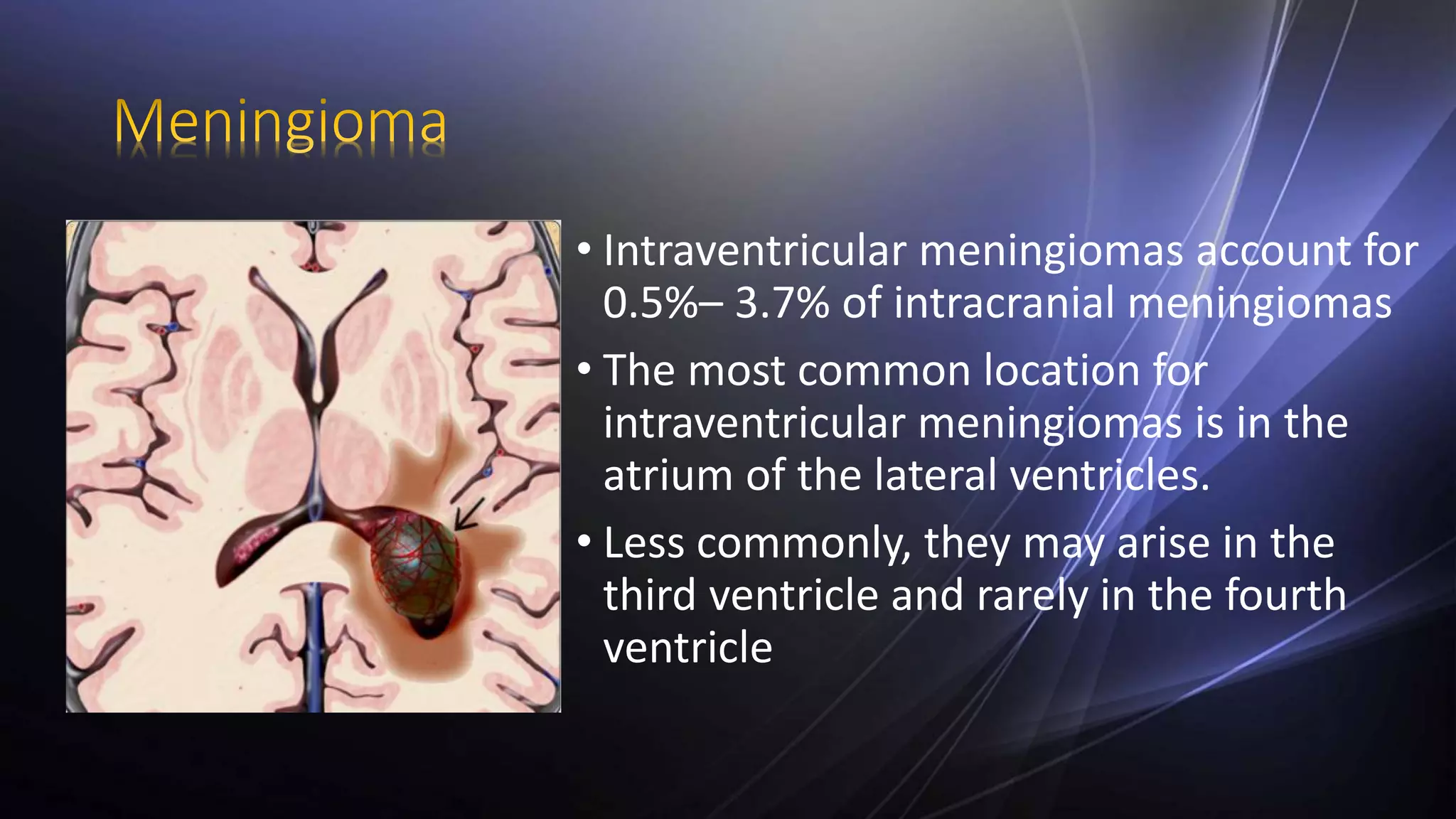 IMAGING OF INTRAVENTRICULAR TUMORS | PPTX