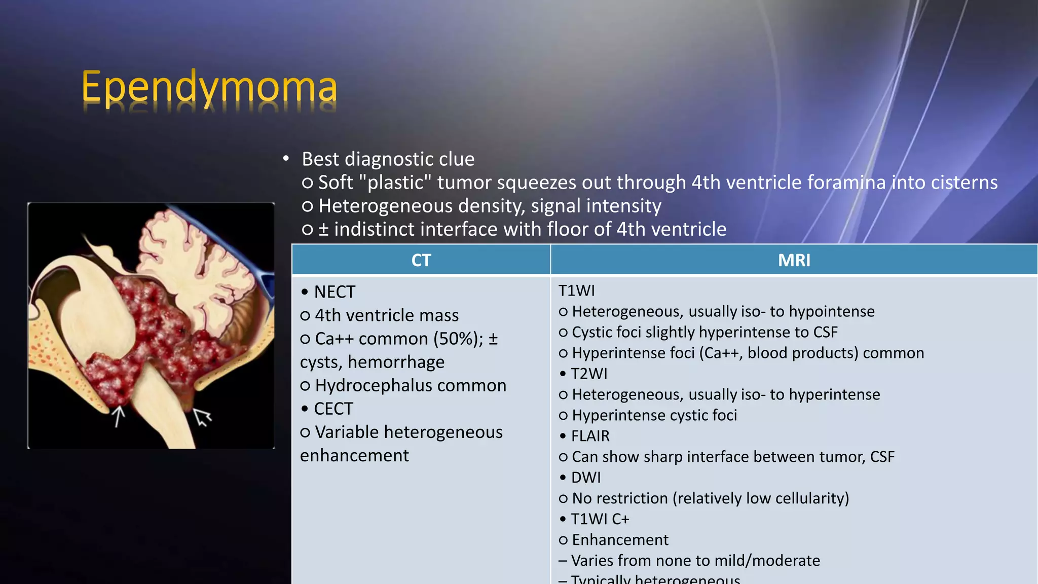 IMAGING OF INTRAVENTRICULAR TUMORS | PPTX