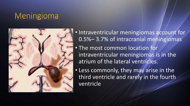 IMAGING OF INTRAVENTRICULAR TUMORS | PPTX