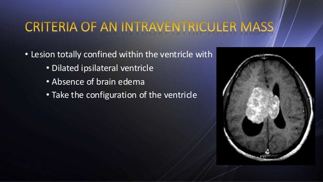 IMAGING OF INTRAVENTRICULAR TUMORS