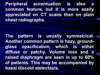 Imaging of IPF | PPT
