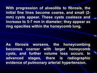 Imaging of IPF | PPT