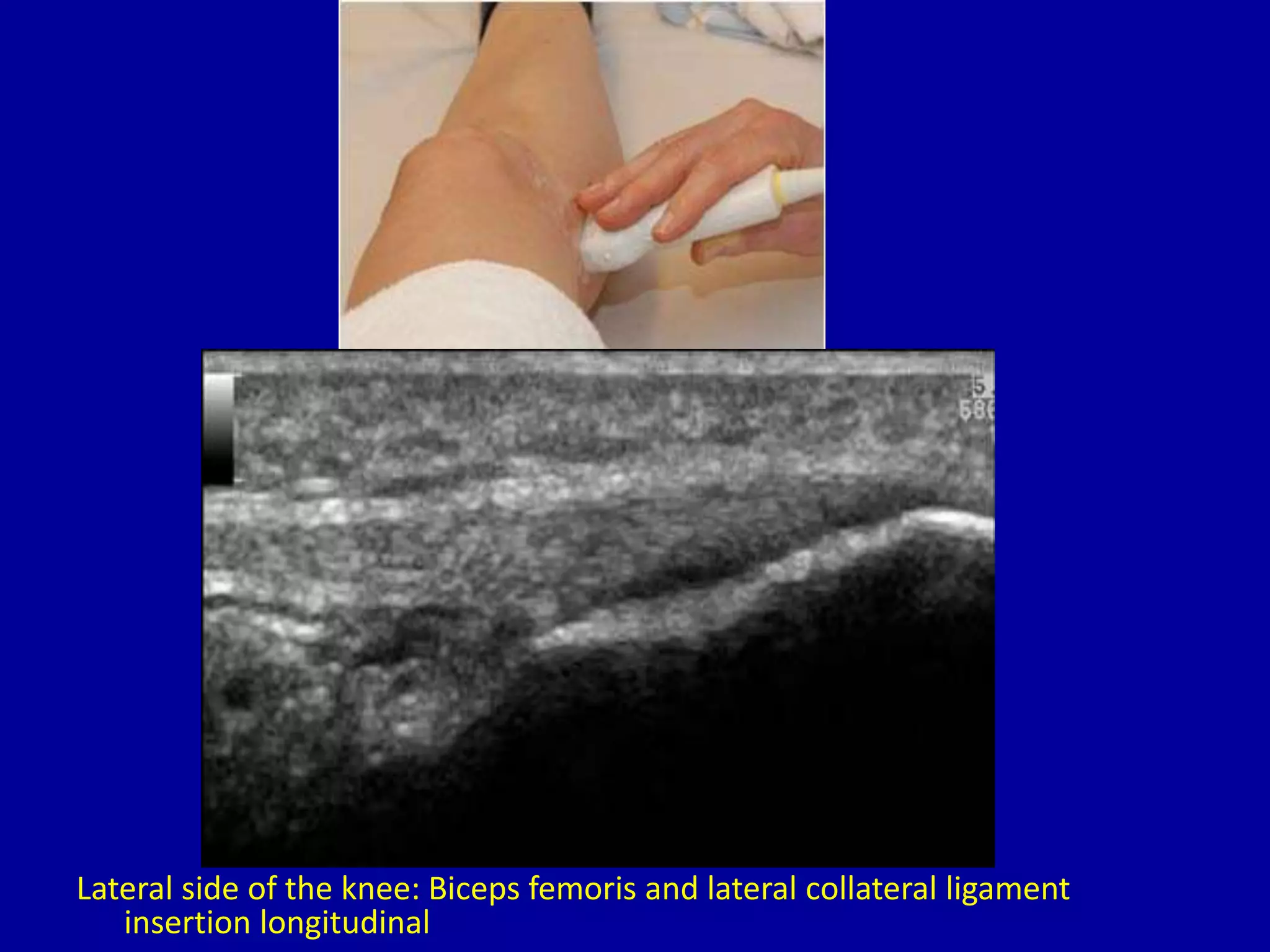 Imaging of knee by mr and usg | PPTX