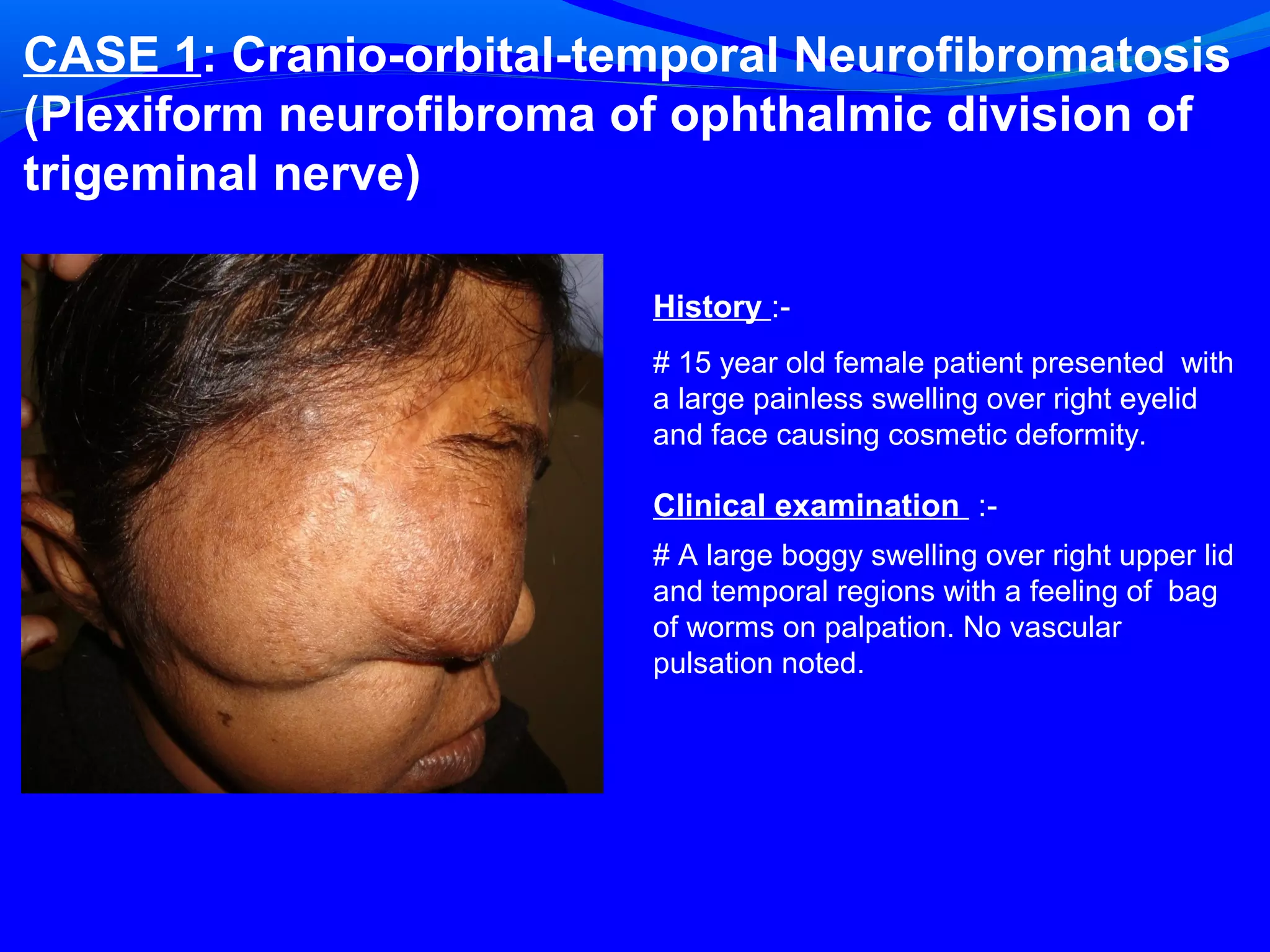 Imaging of neurocutaneous syndrome overview