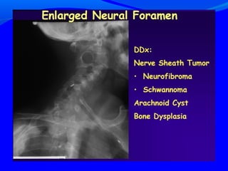 Imaging of neurocutaneous syndrome overview | PPT