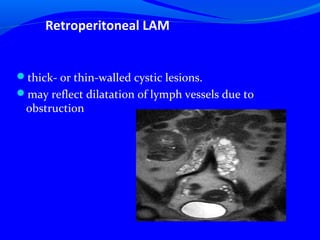 Imaging of neurocutaneous syndrome overview | PPT