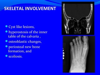 Imaging of neurocutaneous syndrome overview | PPT