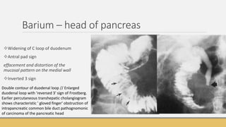 Imaging of non endocrine tumour of pancreas | PPTX