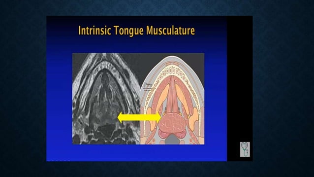 IMAGING OF ORAL CAVITY CANCER-1.pptx