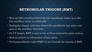 IMAGING OF ORAL CAVITY CANCER-1.pptx