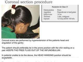 Imaging of paranasal sinuses | PPTX