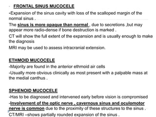 Imaging of paranasal sinuses | PPTX