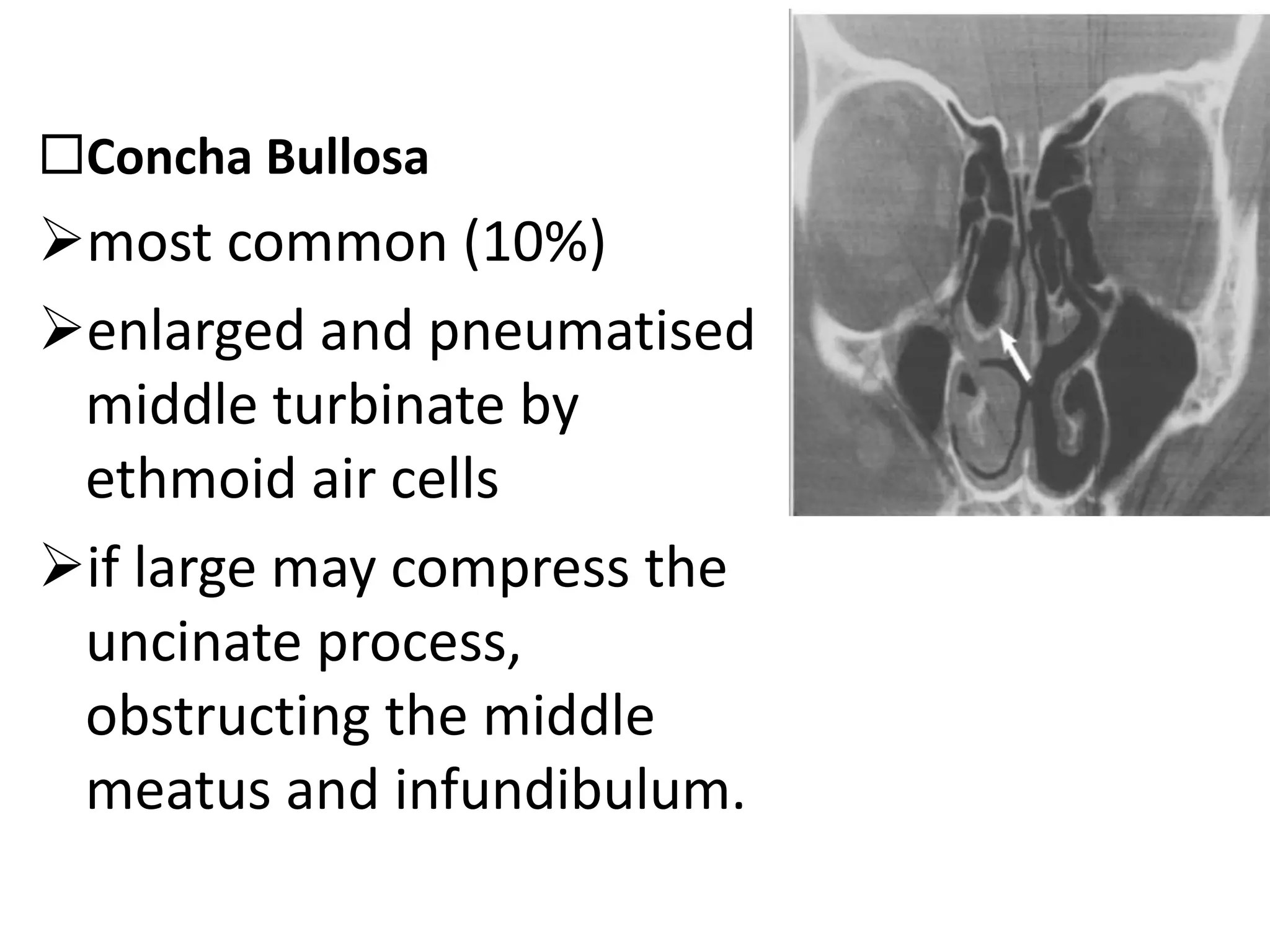 Imaging of paranasal sinuses | PPT