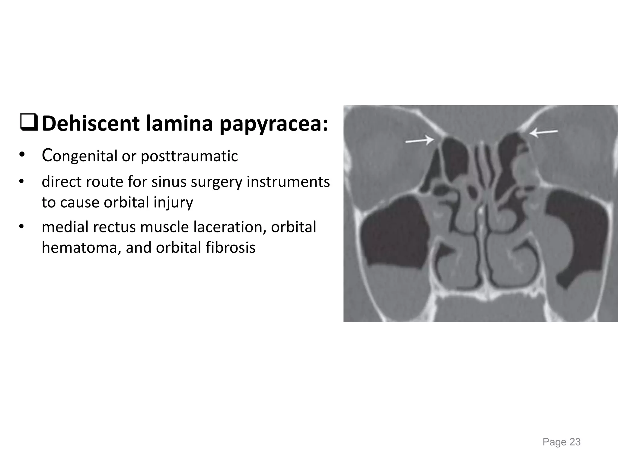 Imaging of paranasal sinuses | PPT