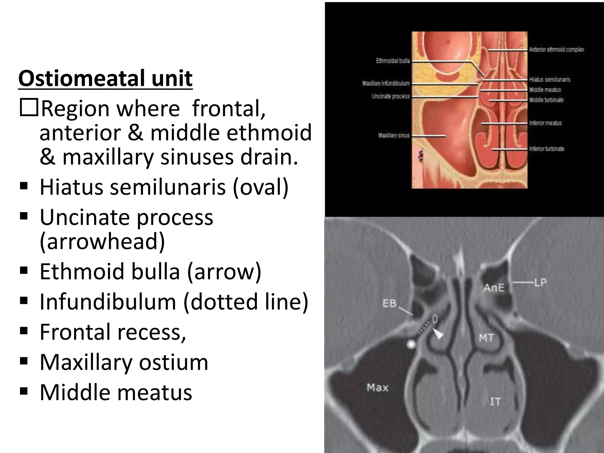 Imaging of paranasal sinuses | PPT