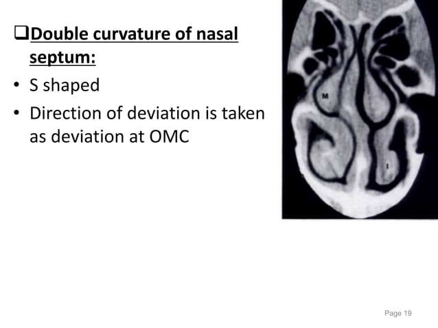 Imaging of paranasal sinuses | PPT | Ear, Nose and Throat Conditions ...
