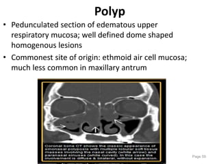 Imaging of paranasal sinuses | PPT