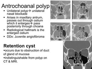 Imaging of paranasal sinuses | PPT