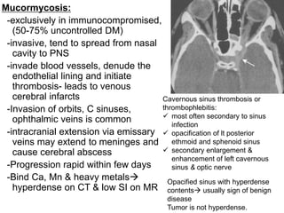 Imaging of paranasal sinuses | PPT
