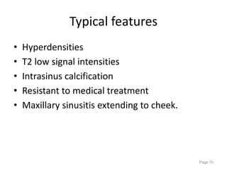 Imaging of paranasal sinuses | PPT