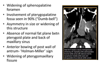 Imaging of paranasal sinuses | PPT