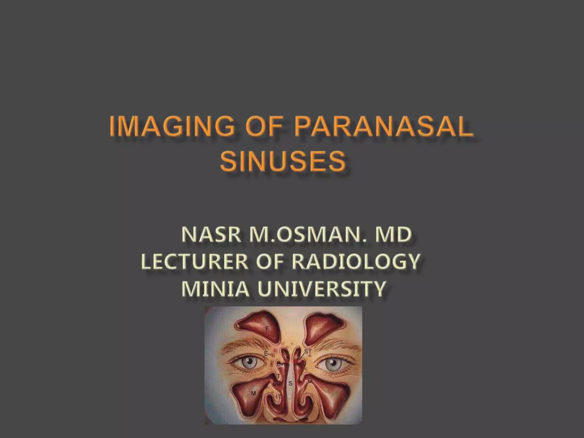 IMAGING OF PARANASAL SINUSES.ppt