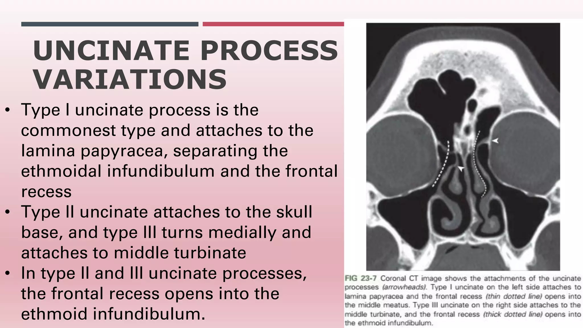 Imaging of paranasal sinuses (including anatomy and varaints)pk1 pdf ...