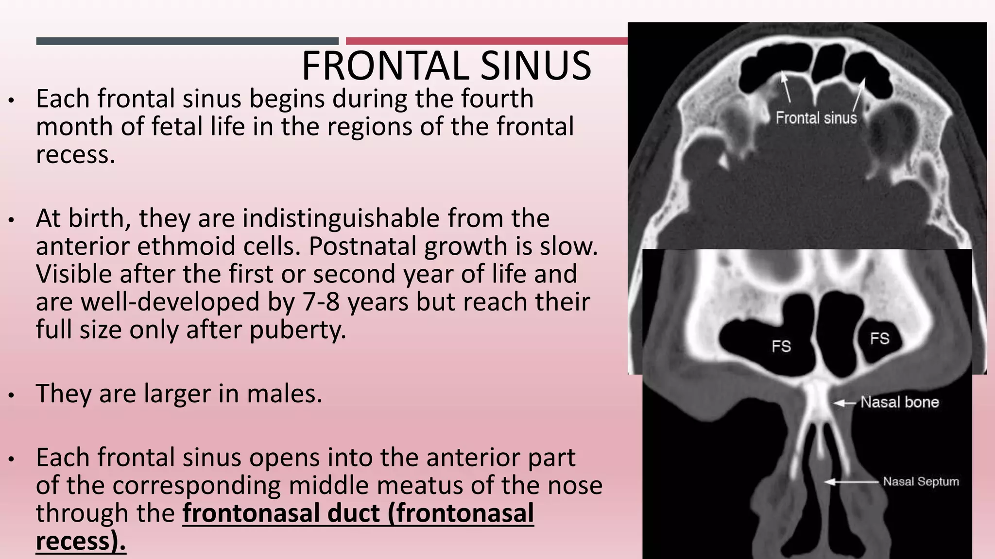 Frontonasal Duct Ct