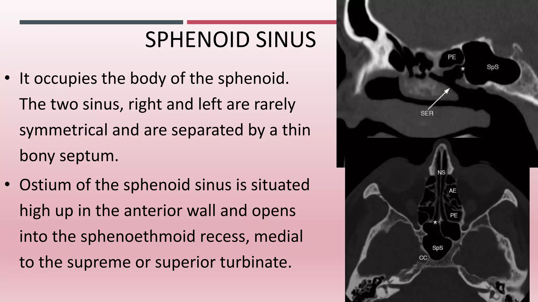 Imaging of paranasal sinuses (including anatomy and varaints)pk1 pdf ...