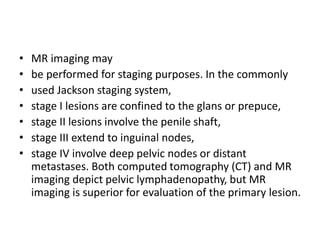 Imaging of penile tumors | PPT