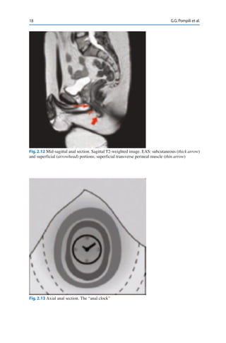 Imaging of perianal inflammatory diseases | PDF