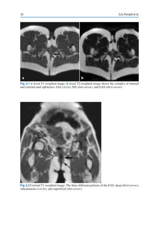 Imaging of perianal inflammatory diseases | PDF